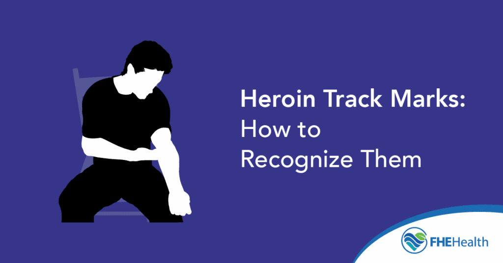 Heroin Track Marks: How to Recognize Them | FHE Health
